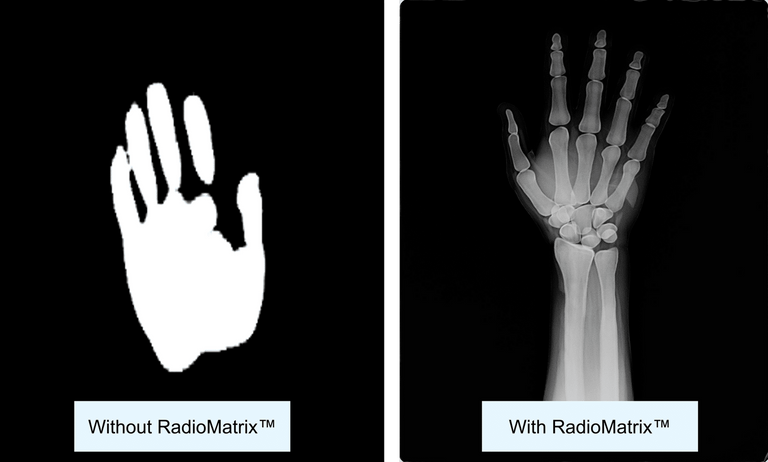 RadioMatrix: El primer material de impresión 3D Radiopaco - Blog 3DCare